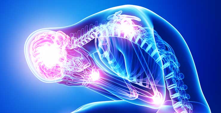 Stress Effects on the Body Stress Effects on the Body
