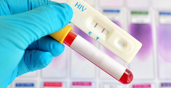 HIV Testing Advice and Resources for Youth