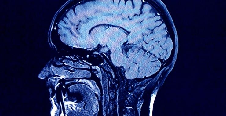 Region in brain found to be associated with fear of uncertain future